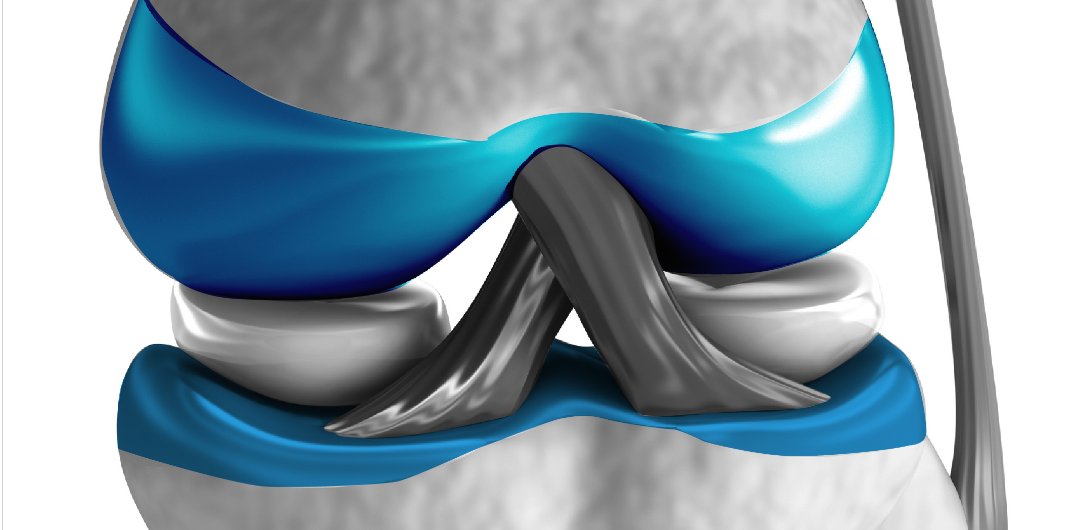 Cartílago Articular de la Rodilla - Praxia Body Repair